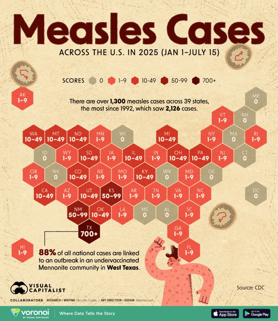 Mapped: Measles Cases by State in 2025 – Visual Capitalist Licensing